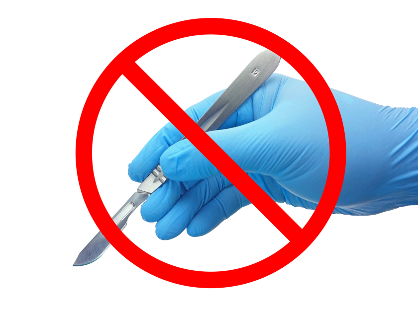 No-Scalpel Procedure – Vasectomy Doctor